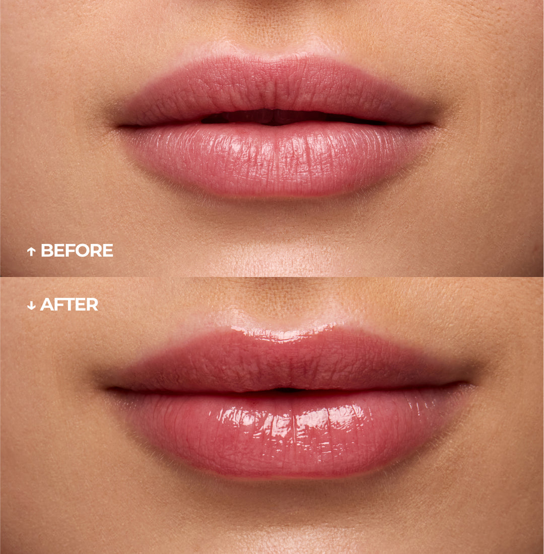 Lip Masks - Hydrate & Plump Your Lips! | Vitamasques